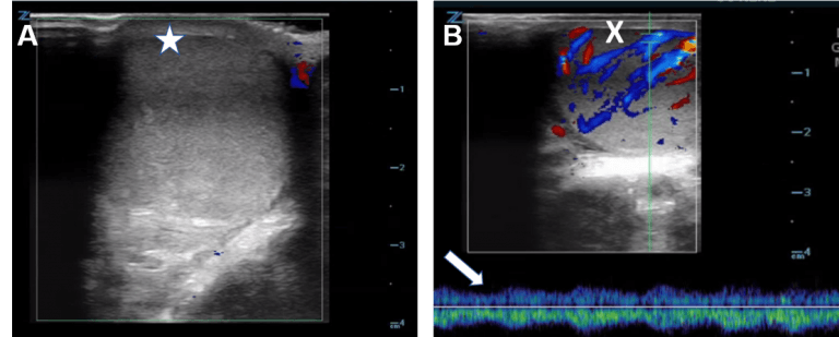 Real-time Point-of-care Ultrasound for the Diagnosis and Treatment of ...