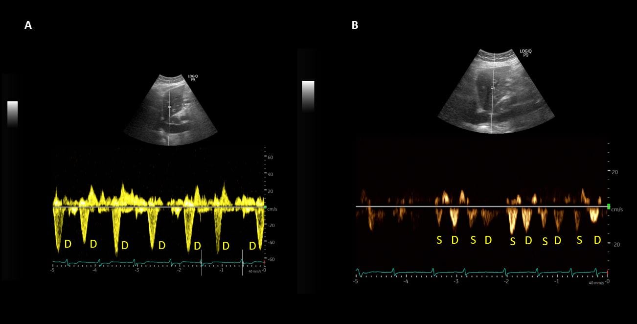 Vol 07 Kidney Issue - FEB 2022 Archives - POCUS Journal