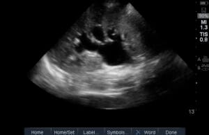 Bedside Assessment of the Kidneys and Bladder Using Point of Care ...