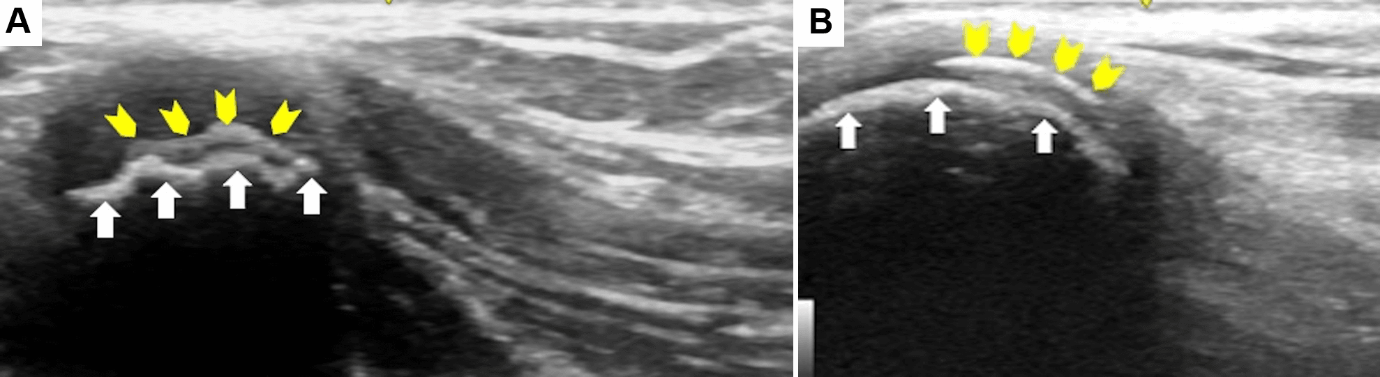 FIgure 2 – Mori et al – POCUS Journal