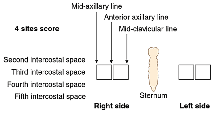Integrative Volume Status Assessment - POCUS Journal