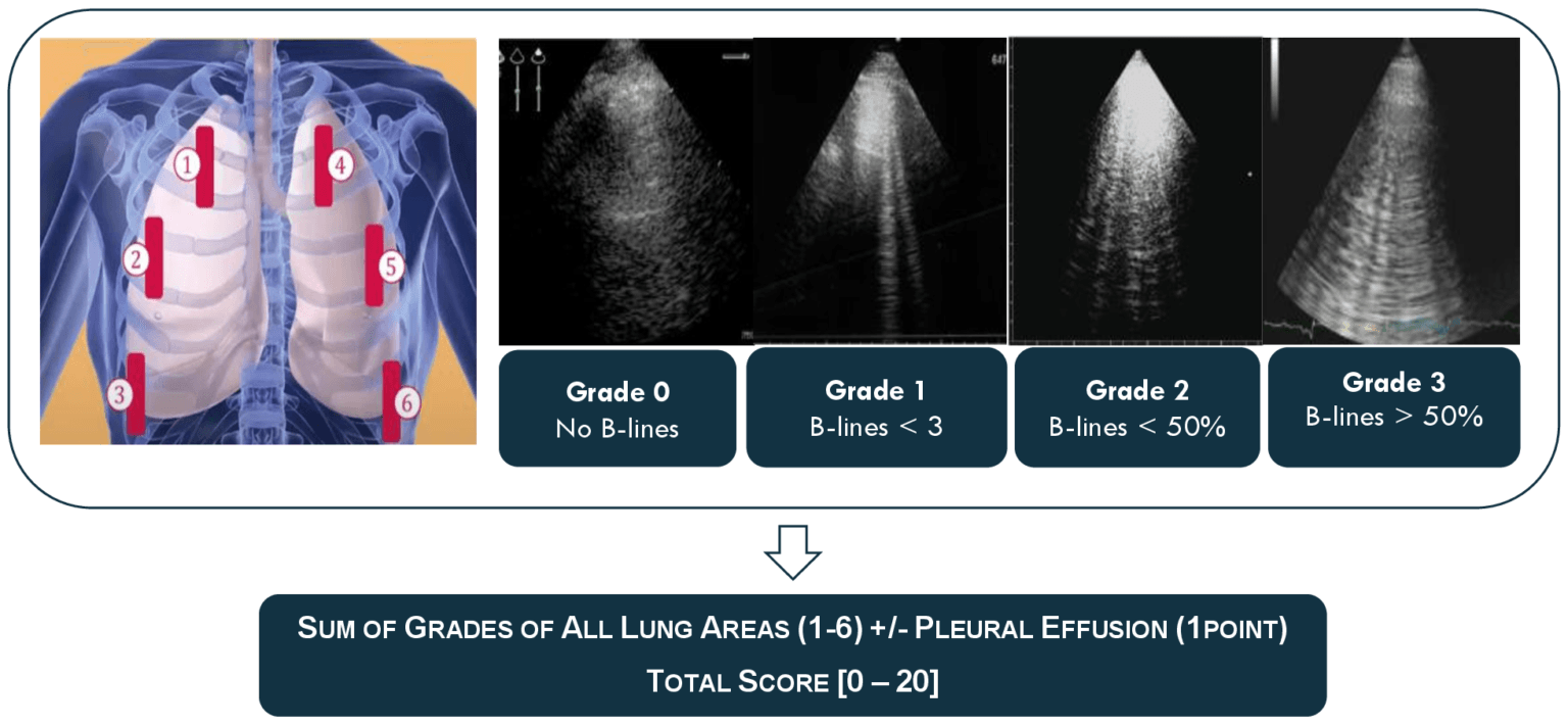 The Expanding Point of Care Ultrasound (POCUS) Paradigm - POCUS Journal