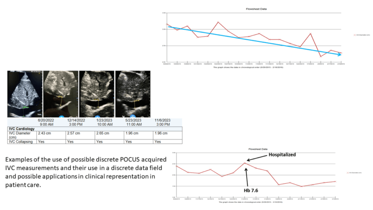 Point of Care Ultrasound for Diagnosis and Management in Heart Failure ...