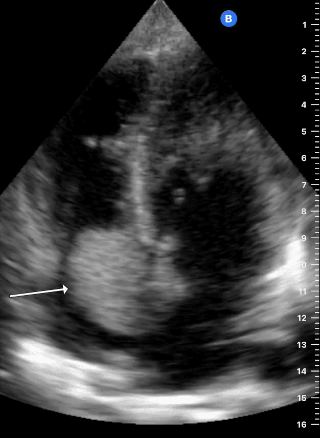 Vol 09 Iss 02 – NOV 2024 Archives - POCUS Journal