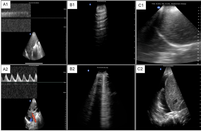 Integrative Volume Status Assessment - POCUS Journal
