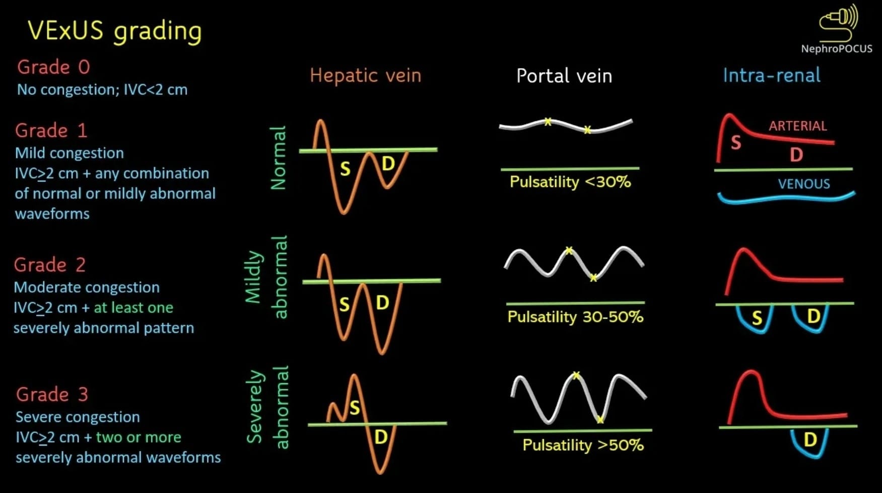 Dengue Cardiomyopathy Treatment Strategy Optimisation by Integrating Point of Care Ultrasound ...