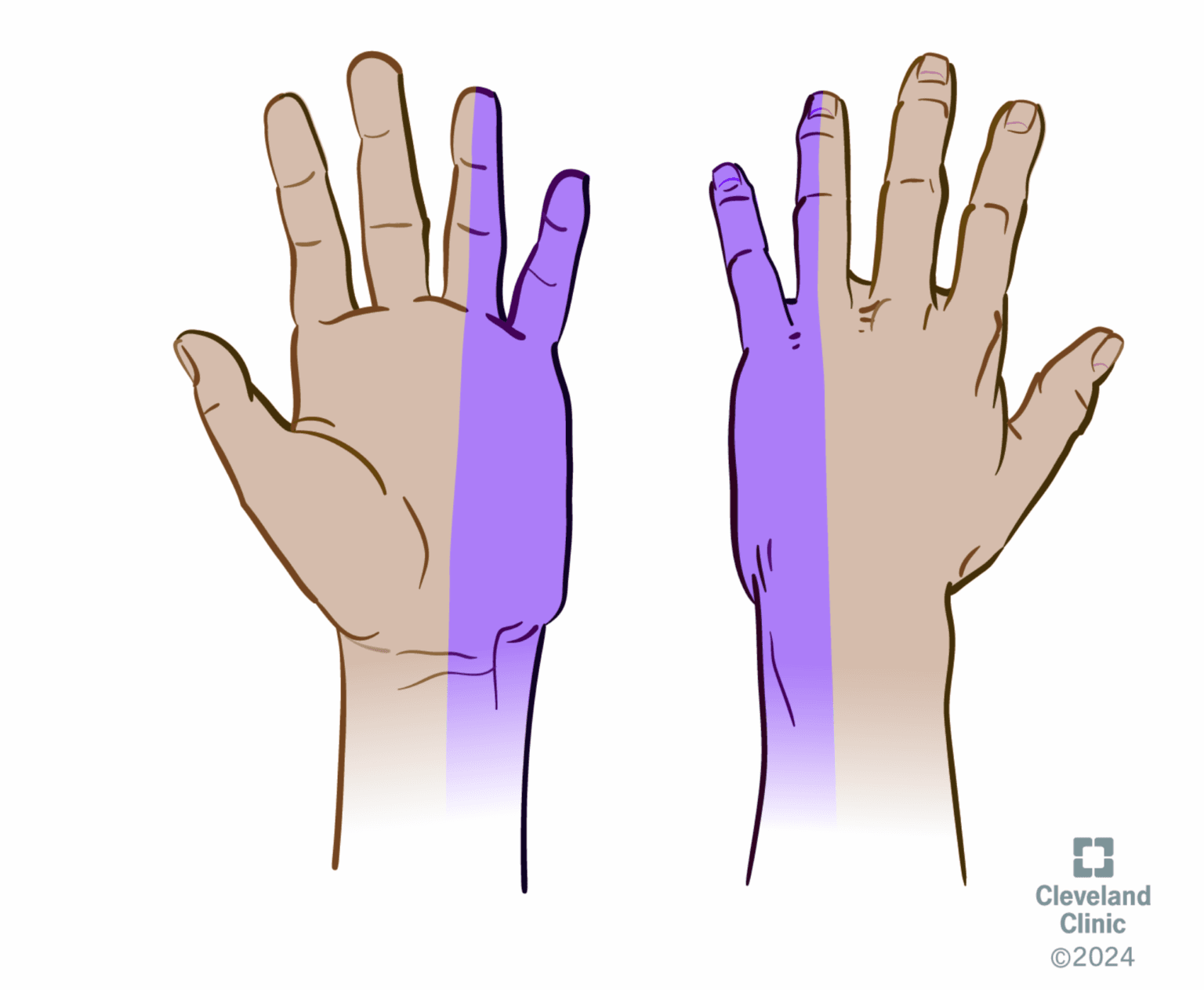 Ultrasound-Guided Nerve Blocks for Flexor Tenosynovitis - POCUS Journal